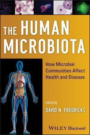 The Human Microbiota How Microbial Communities Affect Health And Disea ...